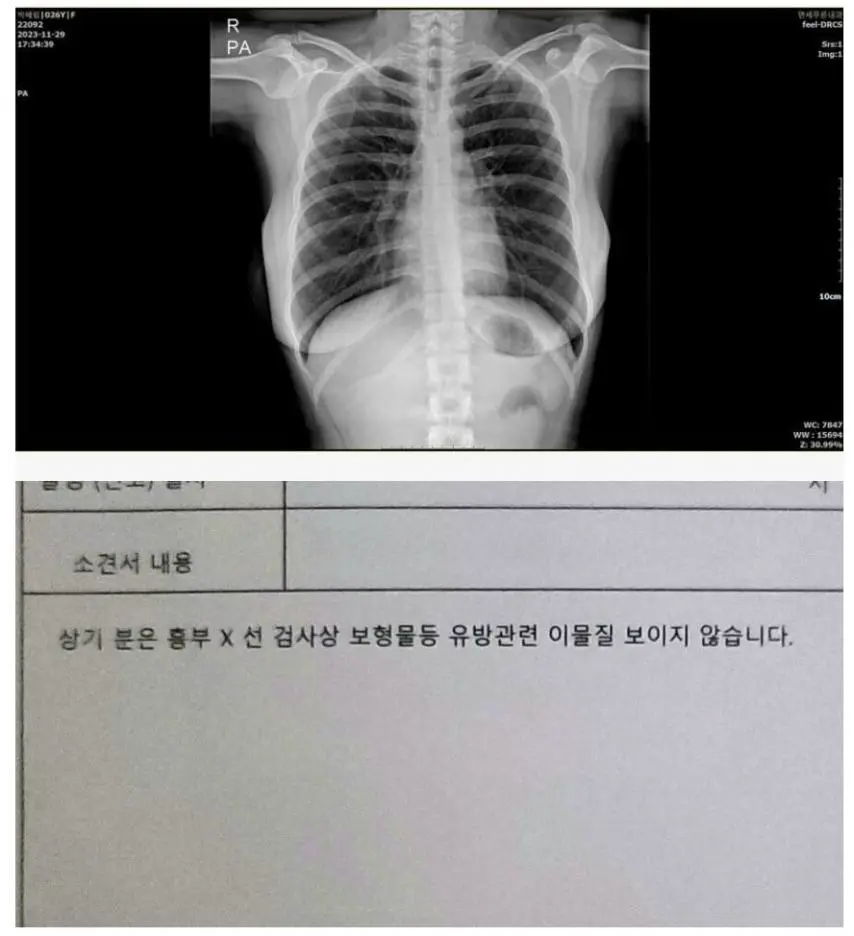 술마시러 온 처자 박혜림 @ip_hyerim 자연산 가슴 노출 - 엠봉 찰카닥